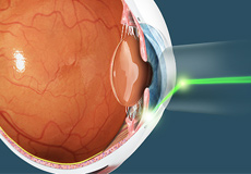 Ophthalmology, Waukesha, Wisconsin | Pro Health Care Medical Associates